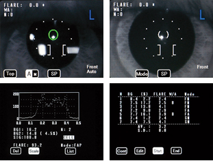 FM-700/FM-600 | レーザーフレアーメーター | 前眼部検査機器 | 製品情報 | コーワ 医療関連機器